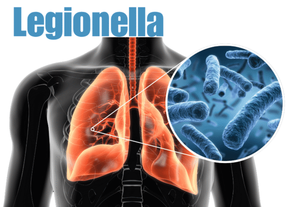 The Cost of a Legionella Crisis for Commercial Properties